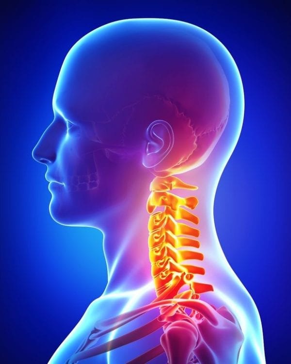 The multifactorial causes and solutions to chronic neck pain - MSK ...