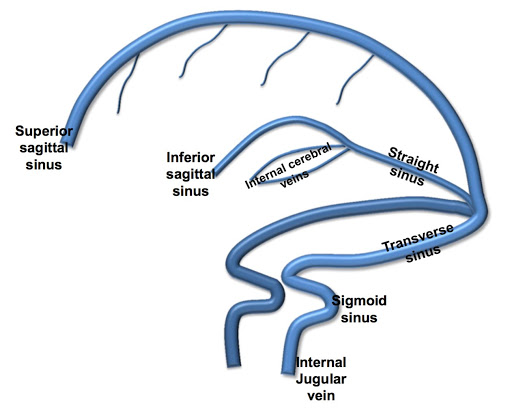 Intracranial hypertension: Beyond CSF. Diagnosis and treatment - MSK ...
